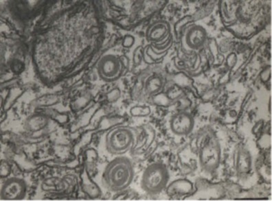 ICAR-indian agricultural research institute